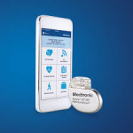 Permanent Pacemaker | Dr Mark Appleby